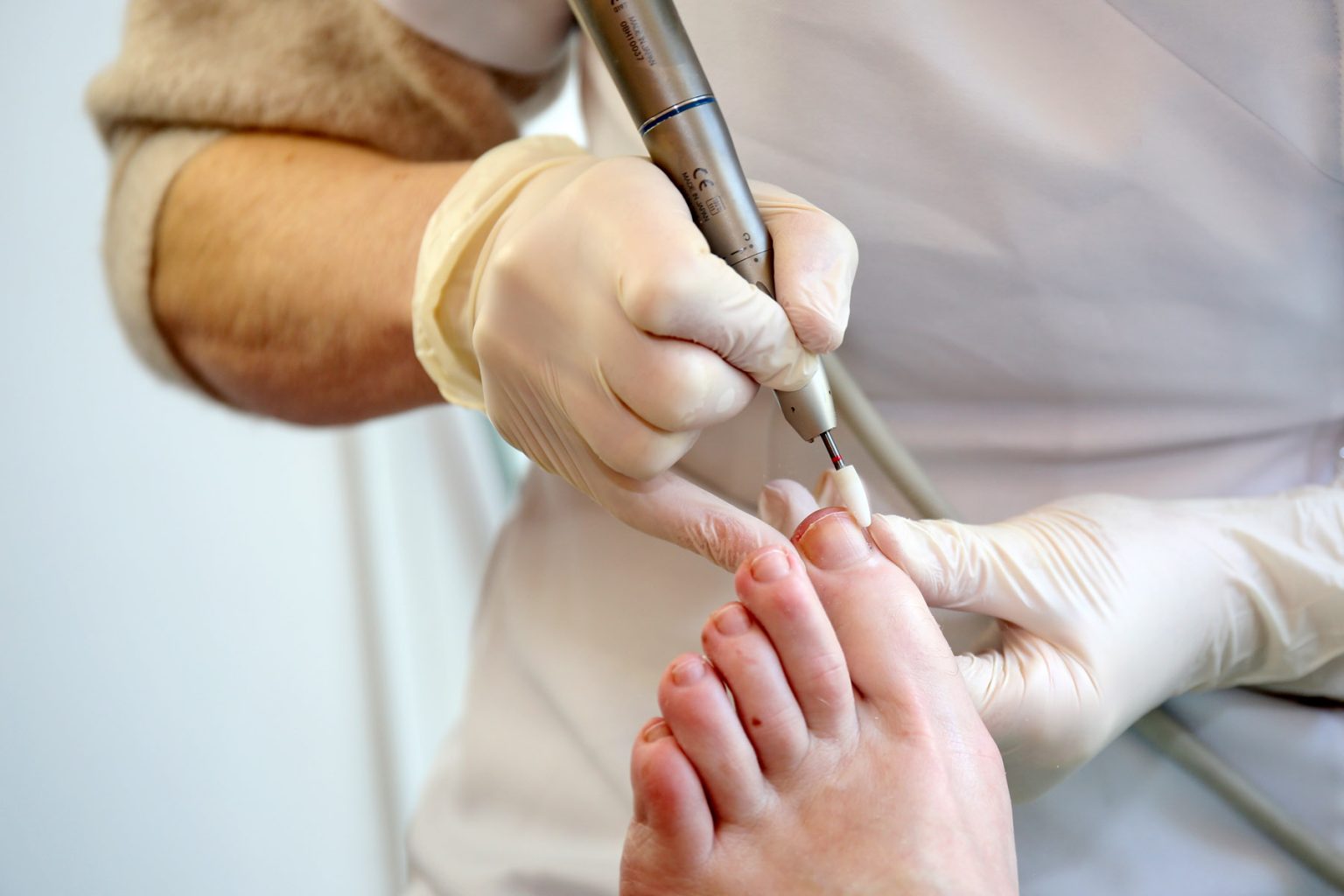 Welkom bij Voet in 't nieuw | Medische pedicure te Kapellen